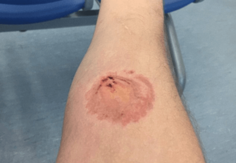 Man Bitten By Violent Passenger ON British Airways Flight