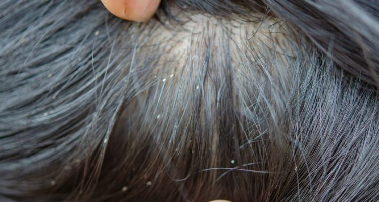American Airlines flight diverted after passengers spot lice in woman's ...