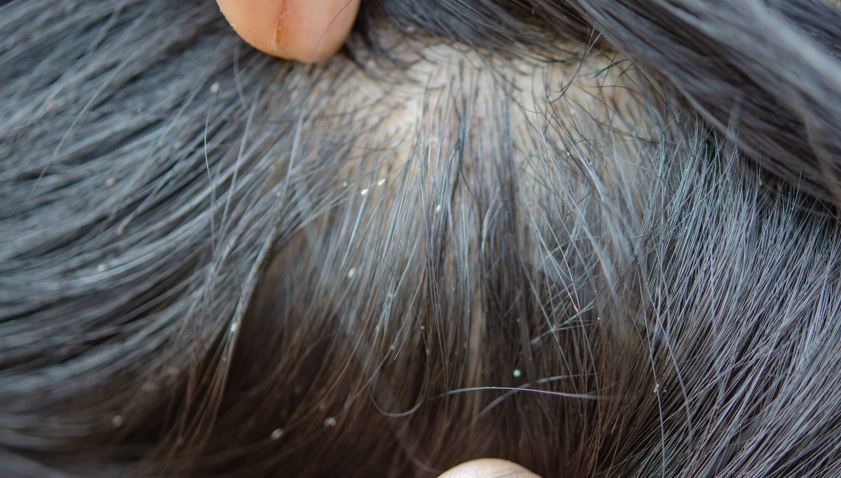 American Airlines flight diverted after passengers spot lice in woman's ...